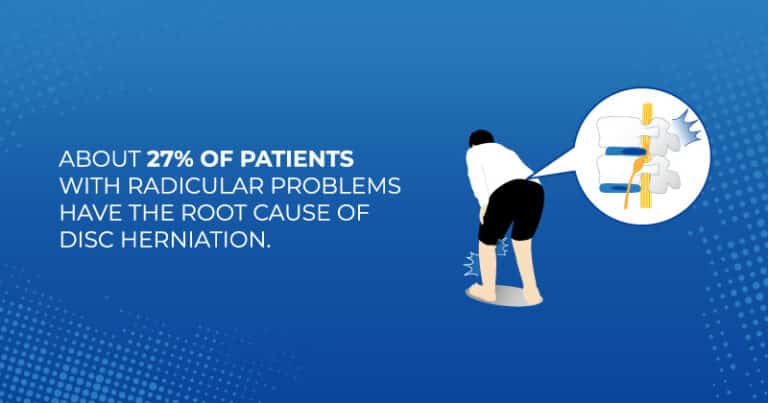 Radicular Pain | Signs And Symptoms | Treatment | J.Flowers