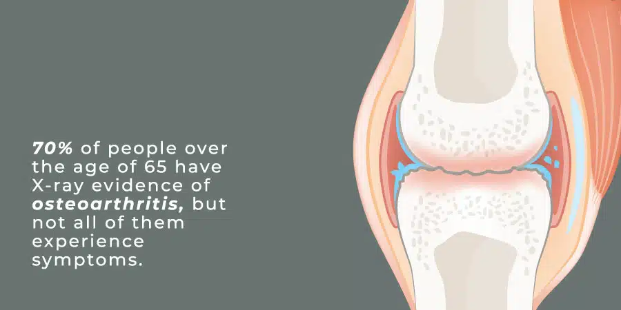 What Is Osteoarthritis | Complications And Treatment